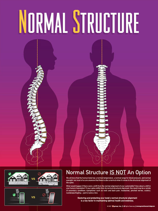 What is a Structural Shift? - Active Life Chiropractic - Redlands CA